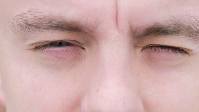 Squinting Stock Footage: Royalty-Free Video Clips - Storyblocks