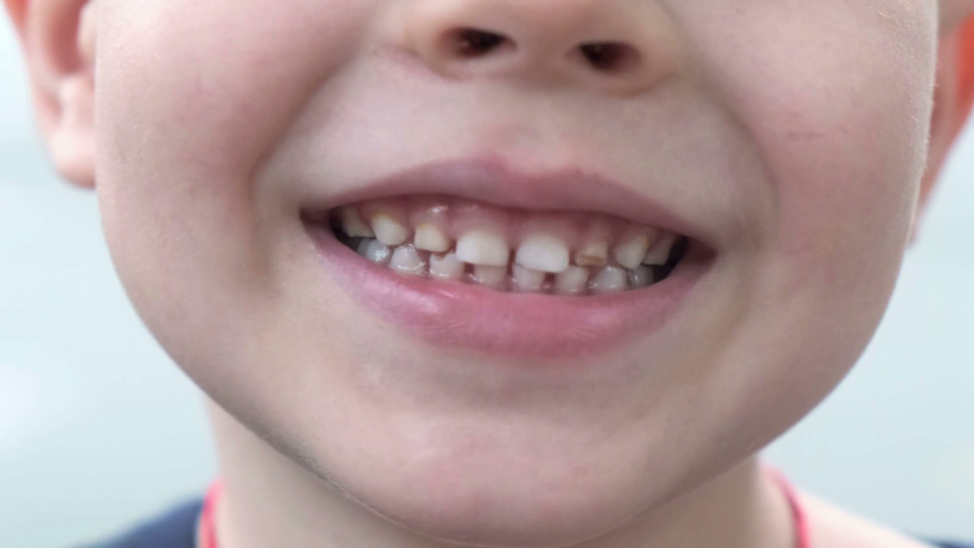 A Young Boy's Joyful Smile On White Stock Footage SBV-335777232 ...