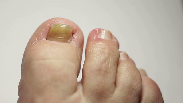 Foot Medical Scan Stock Footage: Royalty-Free Video Clips - Storyblocks