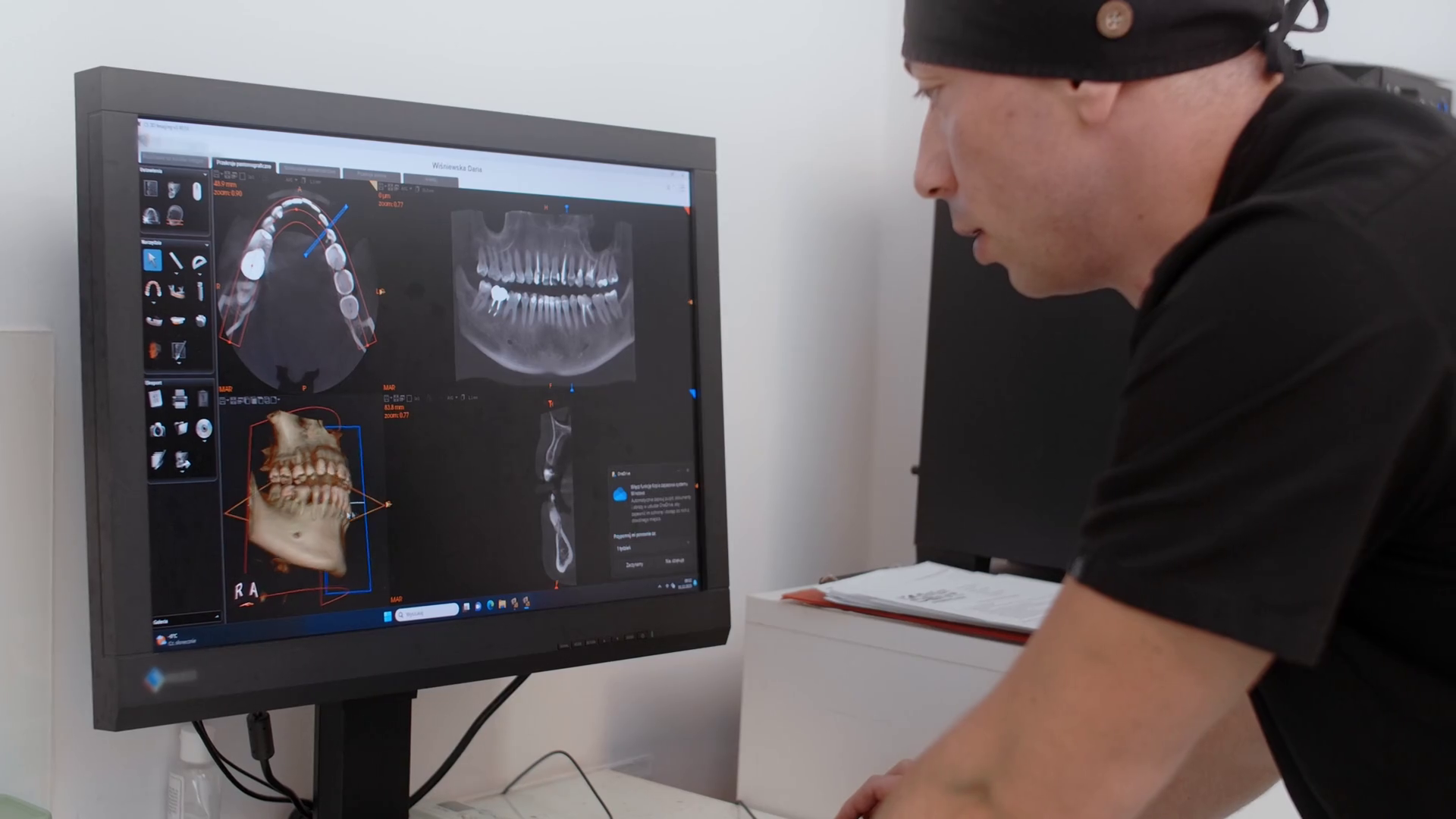 Dentist Surgeon 3d Scan Image Of Jaw Stock Footage SBV-348766591 ...