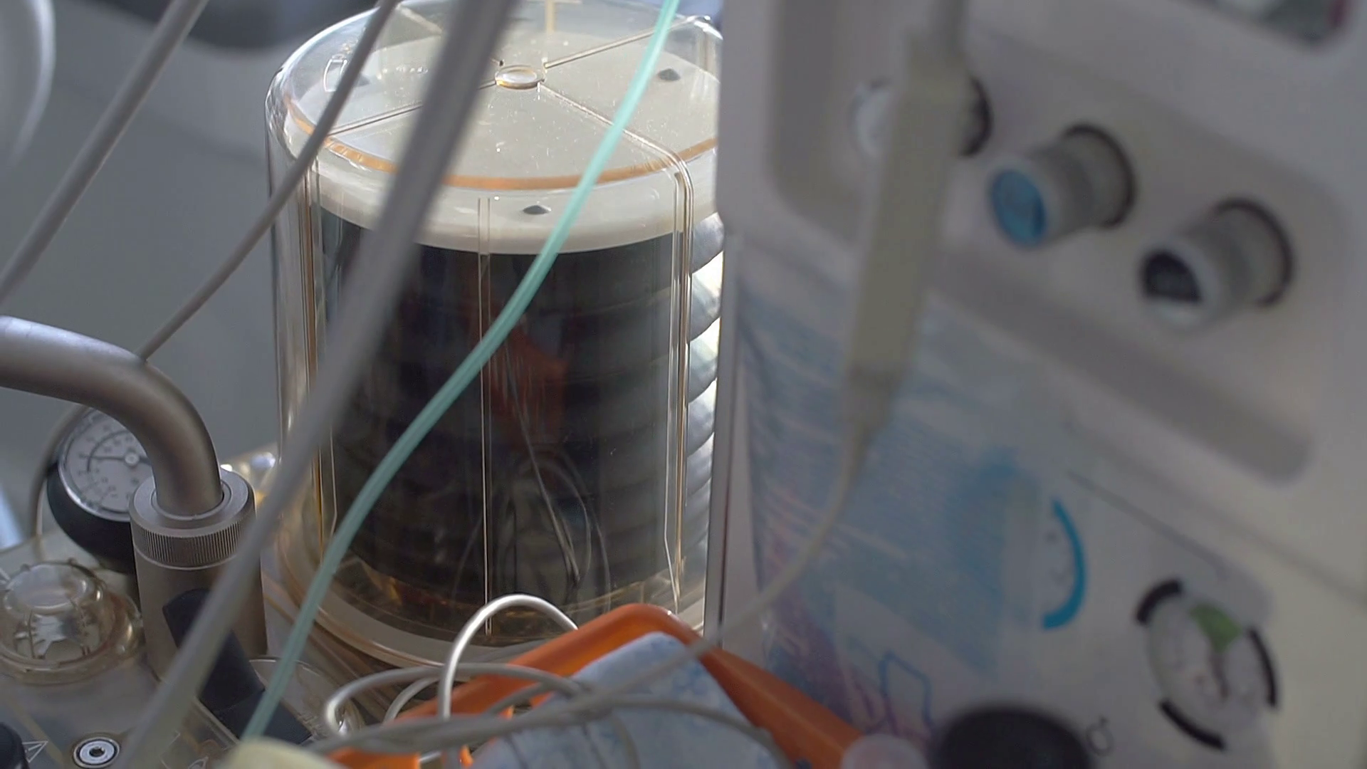 Artificial Respiration System During Stock Footage SBV-313239472 ...