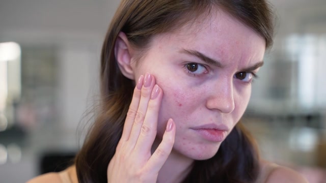 Sensitive Skin Face Stock Footage: Royalty-Free Video Clips - Storyblocks