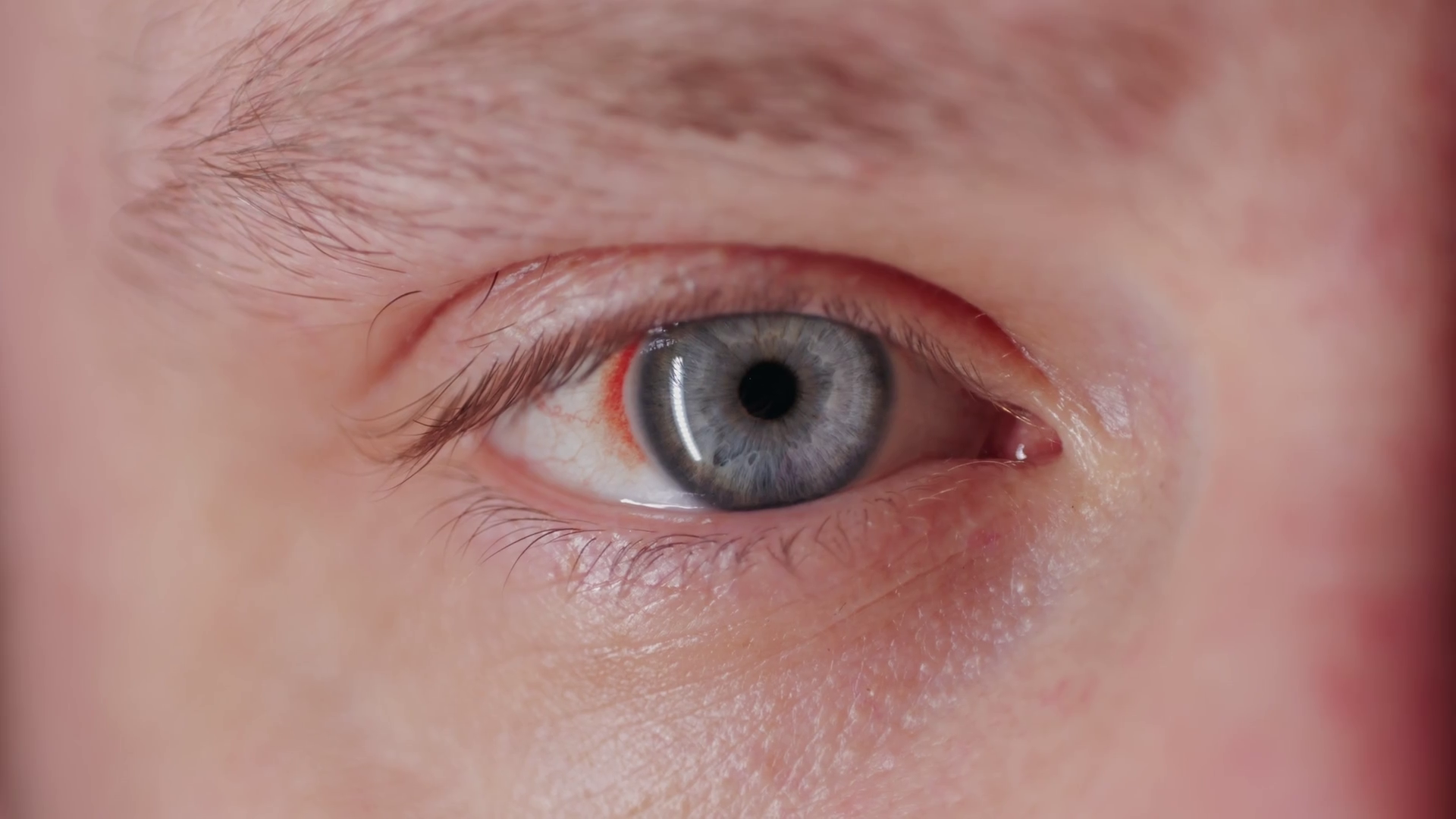 Close Up Blood In Injured Eye Blue Male Eye Stock Footage SBV-347796161 ...