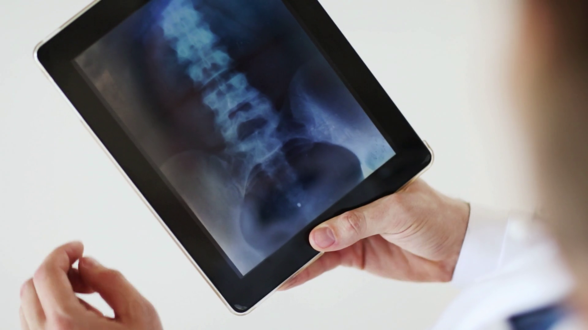 Doctor Working With X-ray Scan On Tablet Pc Stock Footage SBV-301158668 ...