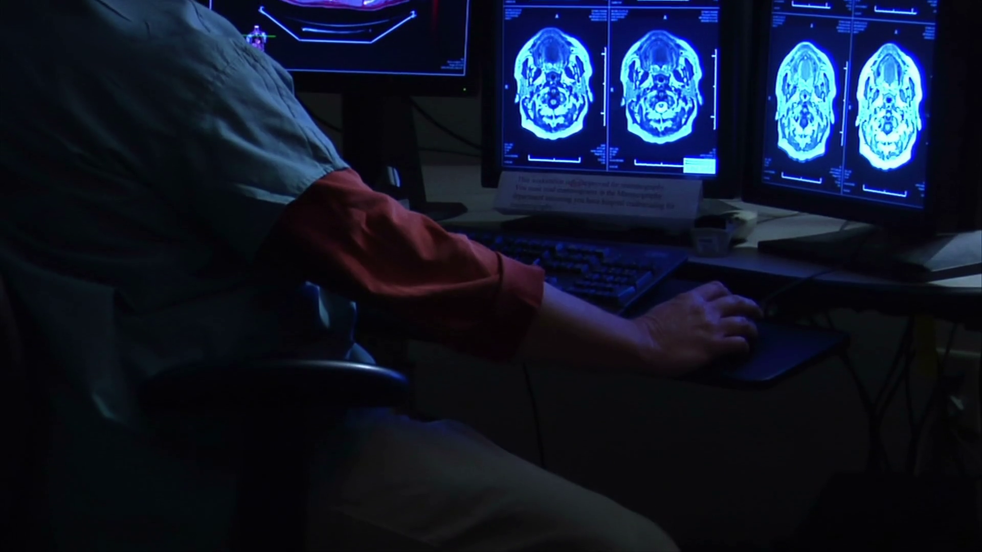 Radiologist Watching Monitors Of Brain Scan Stock Video Footage 00:15 ...