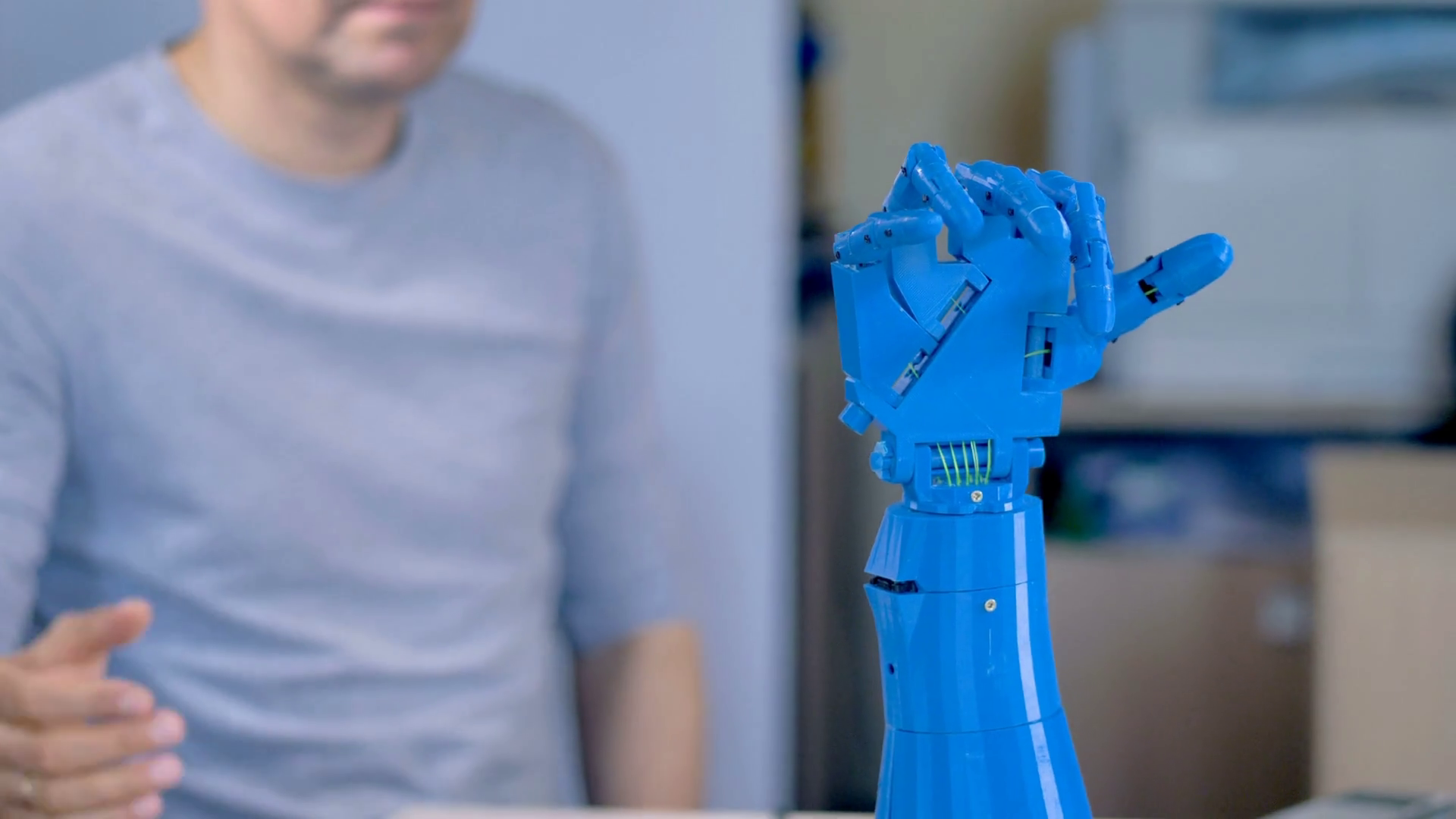 An Engineer Teaches Bionic Arm To Move Stock Footage SBV-315503521 ...