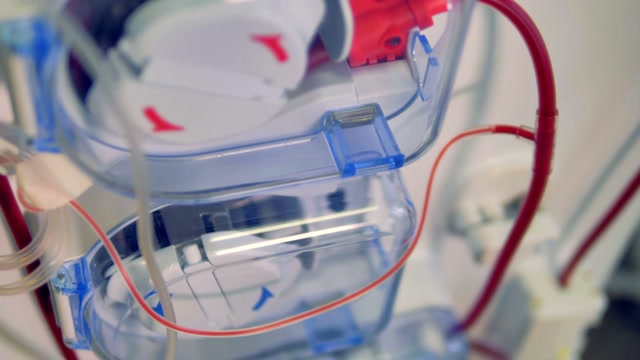 Kidney Dialysis Patient Stock Footage: Royalty-Free Video Clips ...