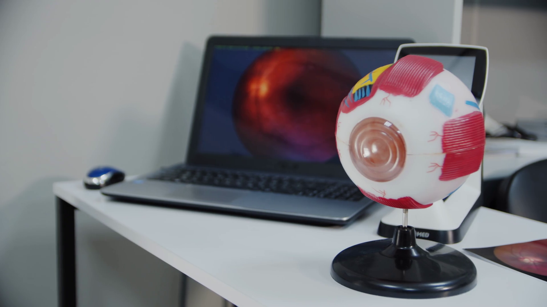 Eye Model On Table In Clinic Stock Footage SBV-346823799 - Storyblocks