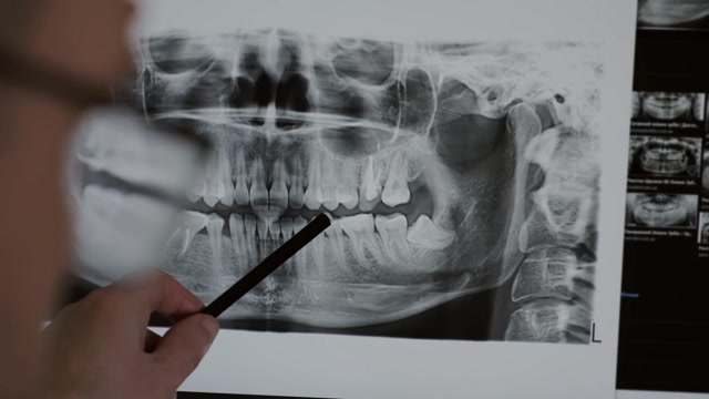 Dental Diagnosis Stock Footage: Royalty-Free Video Clips - Storyblocks