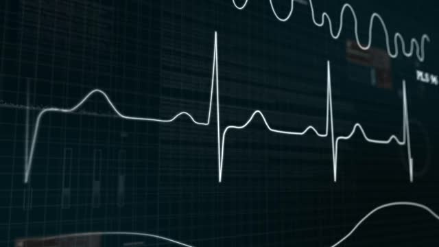 Heartbeat Stock Footage: Royalty-Free Video Clips - Storyblocks