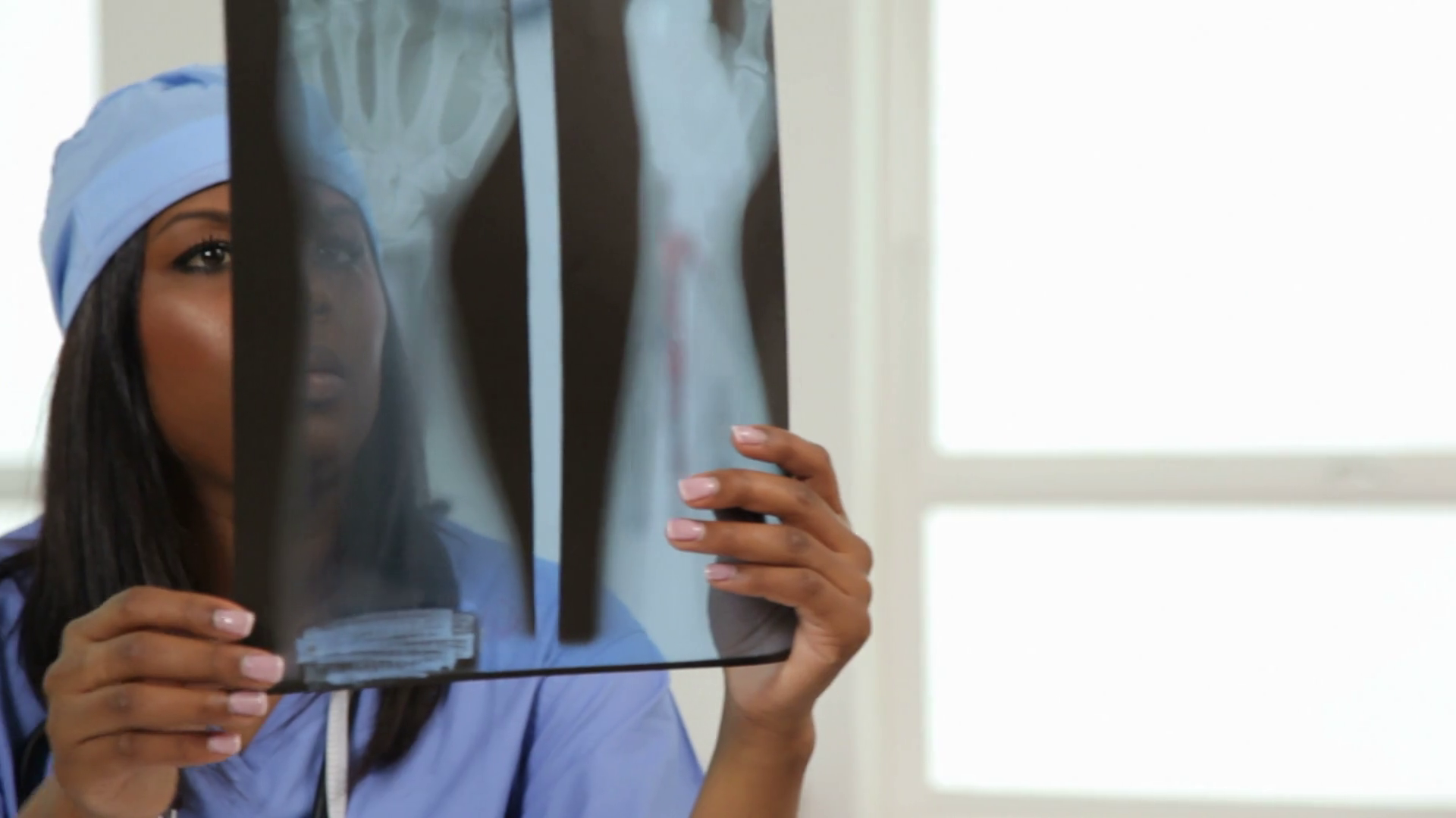 Surgeon Reviews X-ray Stock Footage SBV-348369368 - Storyblocks