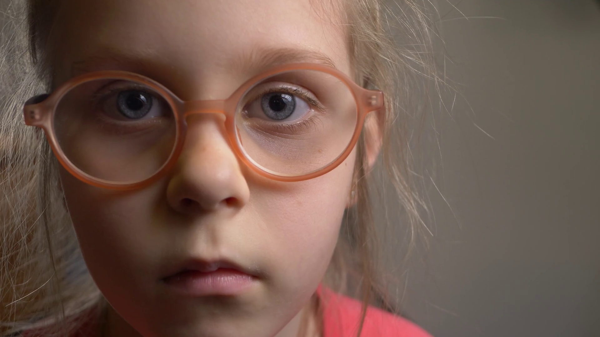 Little Girl In Glasses With Eye Problem Stock Footage SBV-348572124 ...