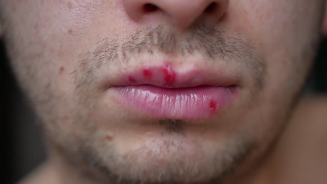 Sick Senior Stock Footage: Royalty-Free Video Clips - Storyblocks