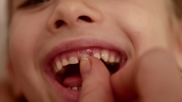 Dentist Free Stock Footage: Royalty-Free Video Clips - Storyblocks
