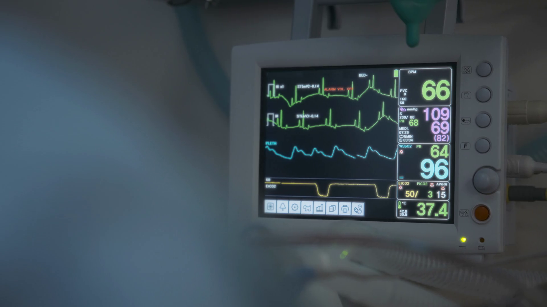 Screen Of Monitor Showing Vital Signs Of Stock Footage SBV-347727436 ...