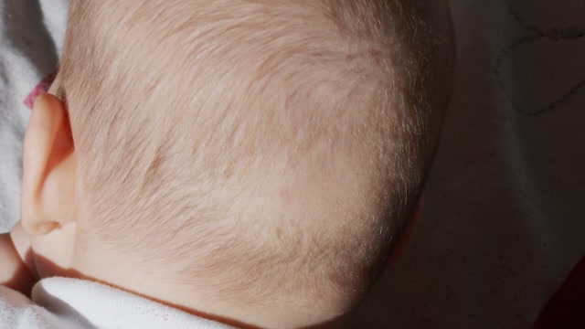Hair Transplant Stock Footage: Royalty-Free Video Clips - Storyblocks