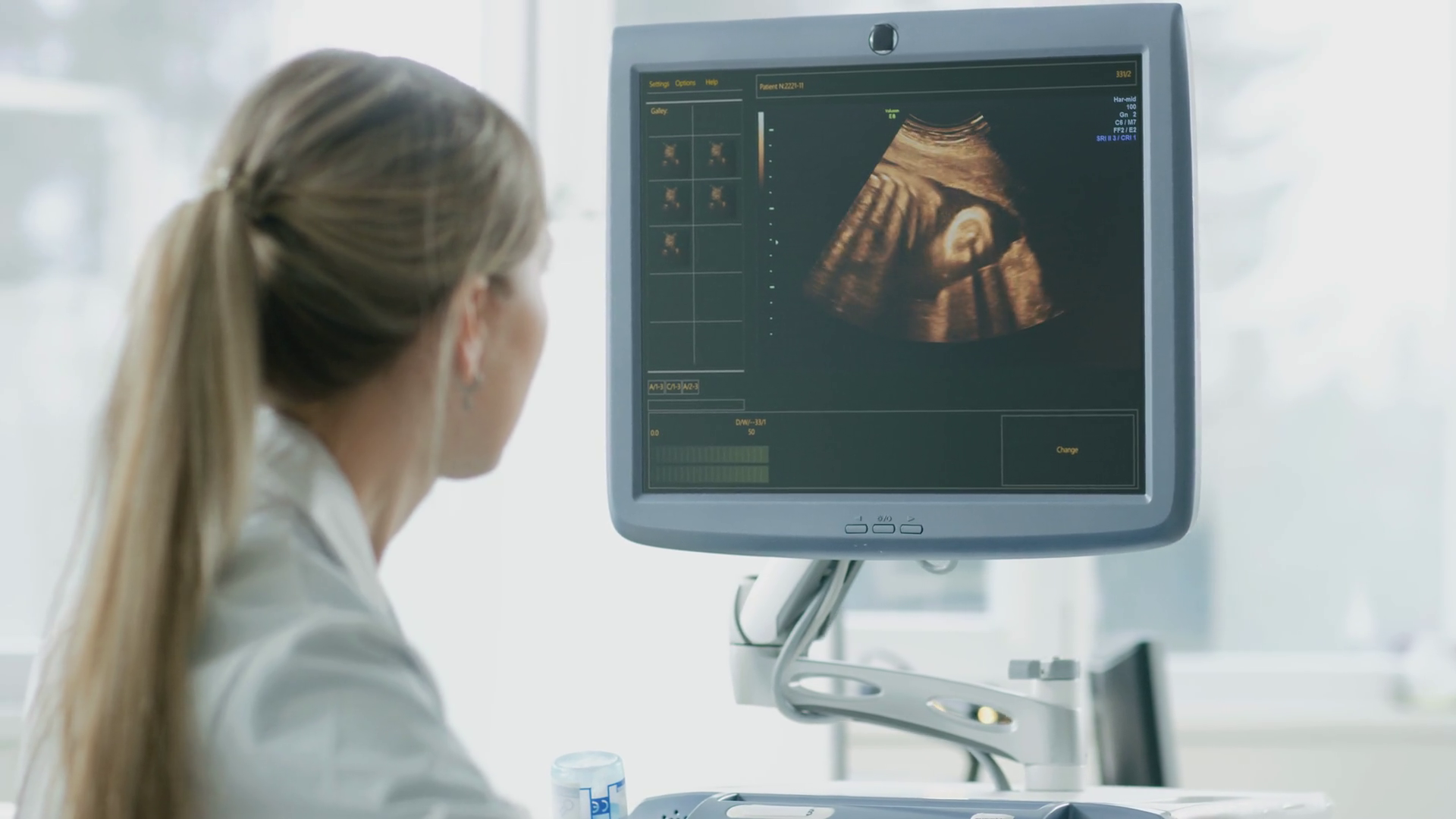 In Hospital Pregnant Woman Getting Sonogram Stock Footage SBV-353494644 ...