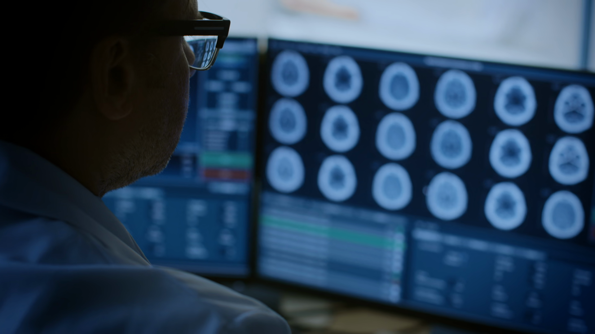In Medical Laboratory Patient Undergoes Mri Stock Footage SBV-353694632 ...
