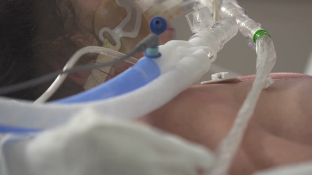 Icu Patient Stock Footage: Royalty-Free Video Clips - Storyblocks