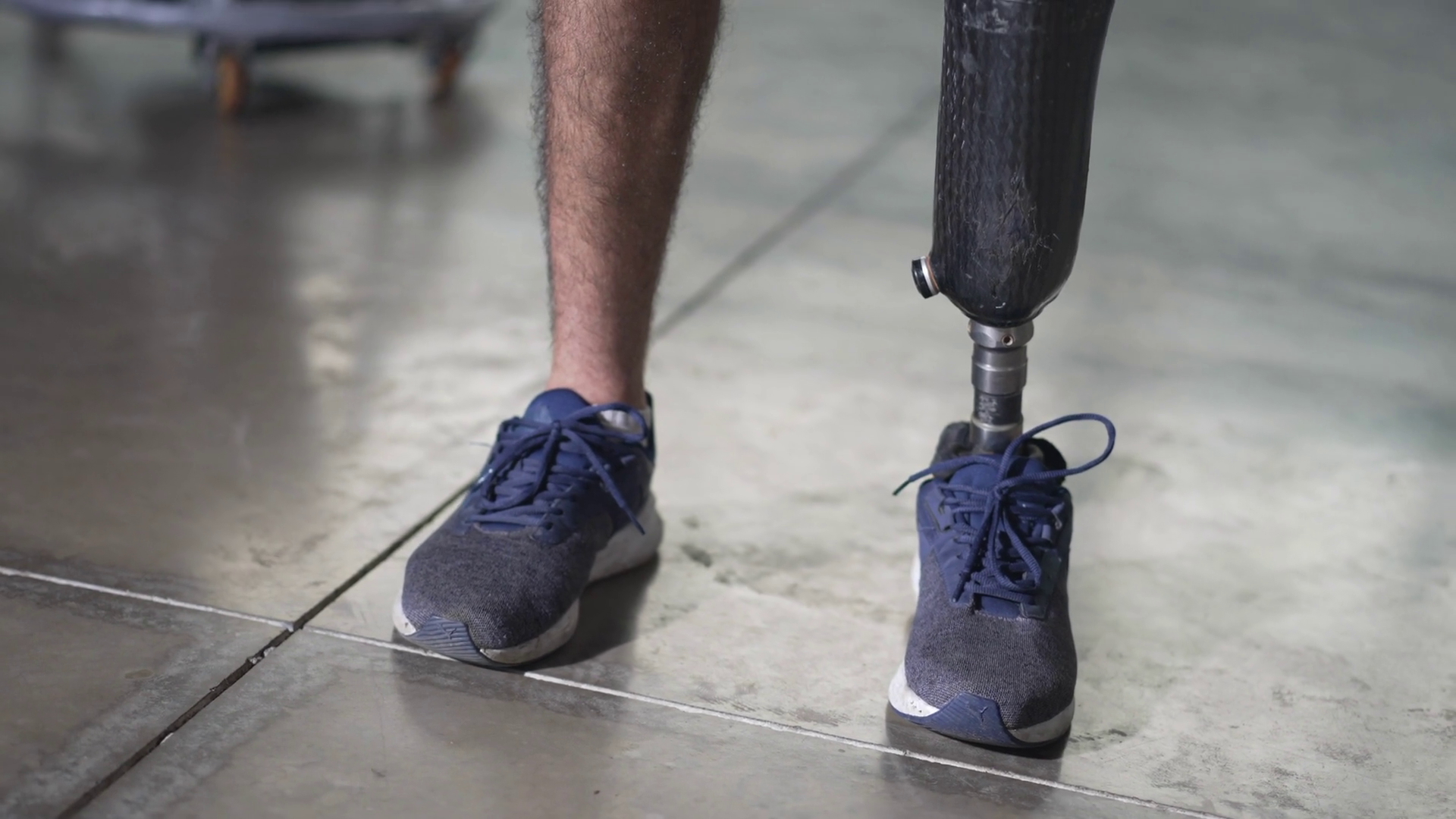 Prosthetic Leg Closeup: Standing Tall With Stock Footage SBV-348397506 ...