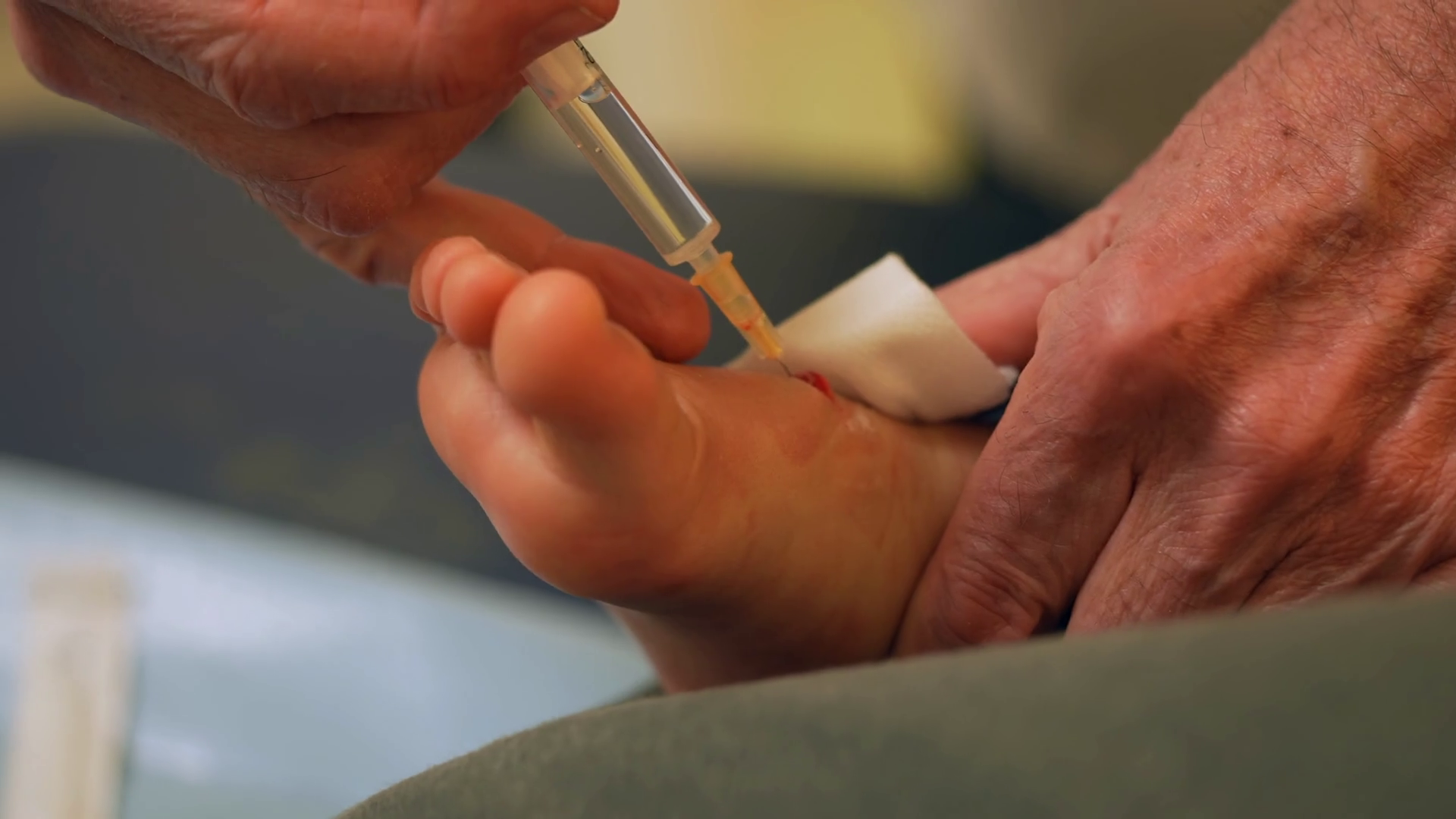 Doctor Hand Closeup Applying Local Stock Footage SBV-348683936 ...