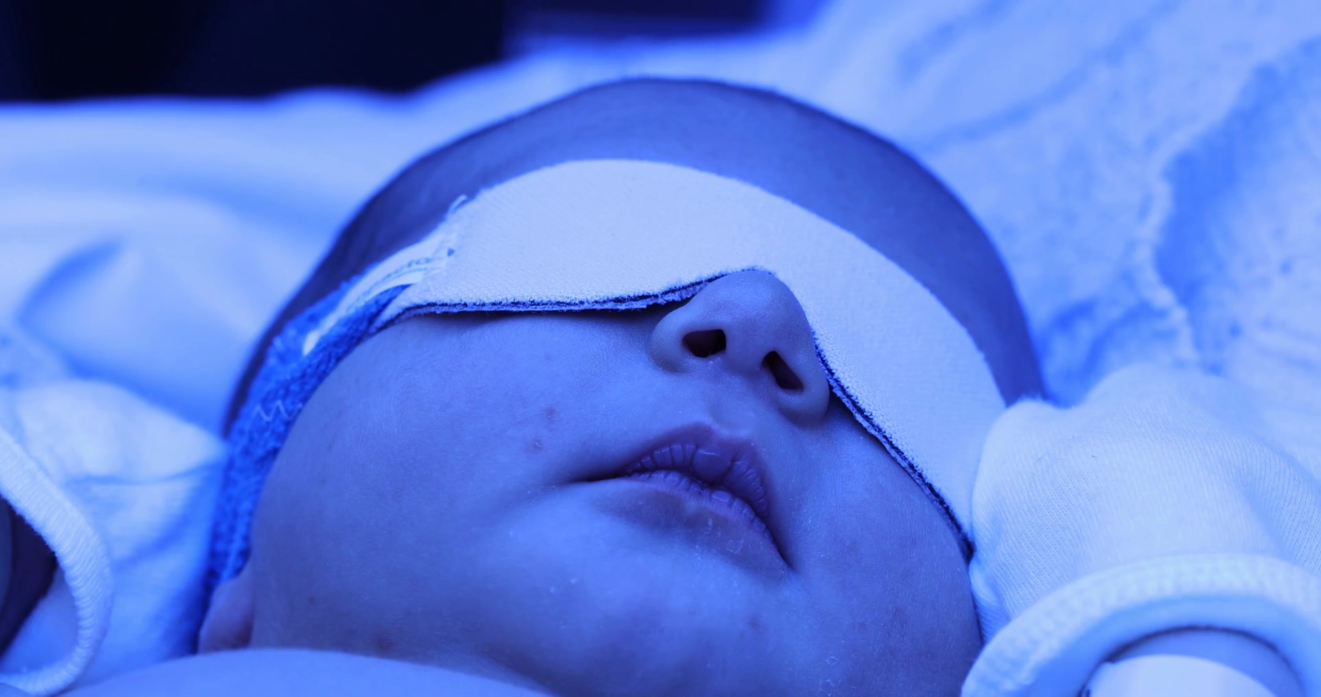 Treating Newborn Boy's Jaundice Under Stock Footage SBV-348432443 ...