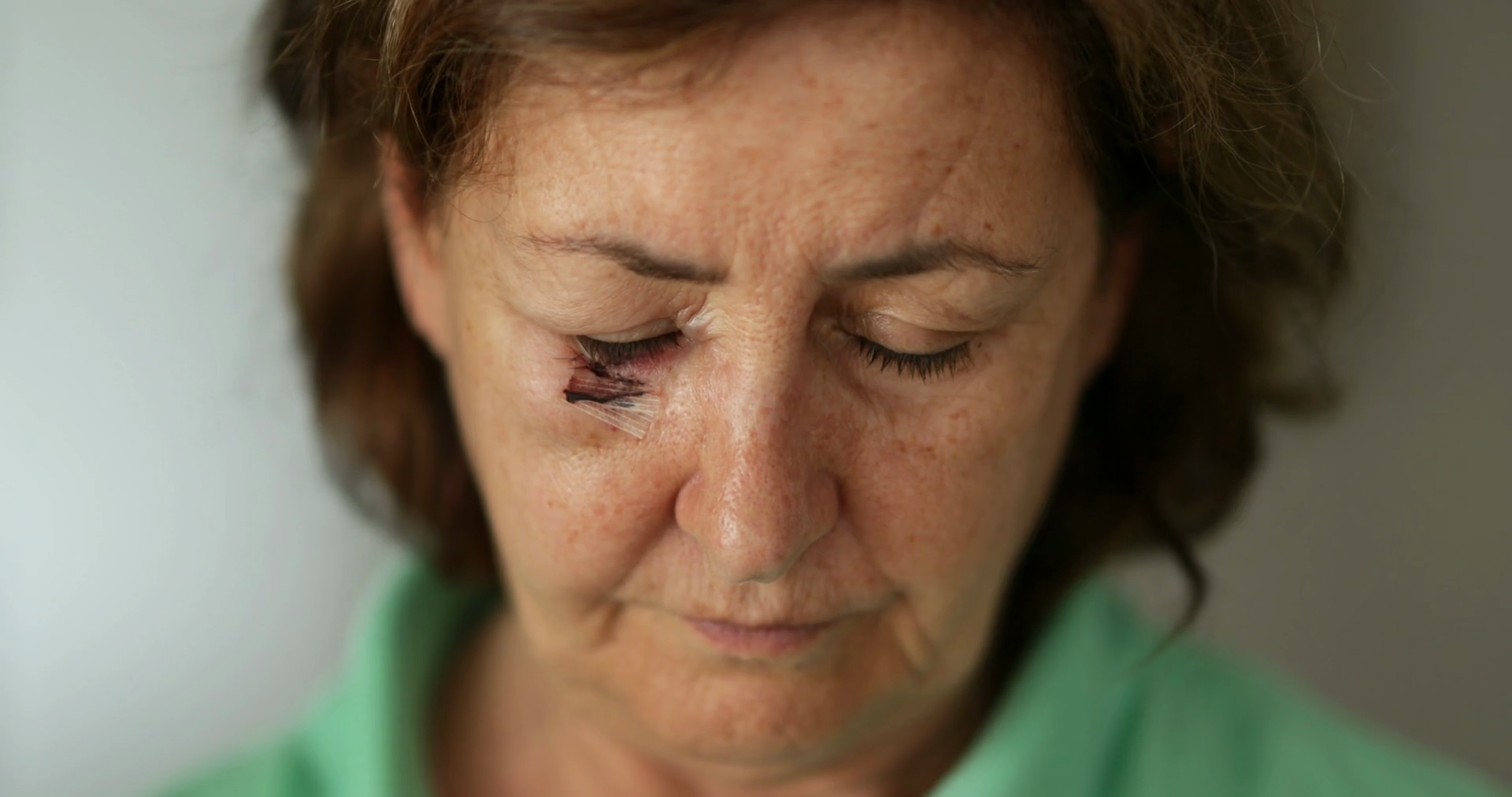 Older Woman With Beaten Face With Scar Stock Footage SBV-348480454 ...