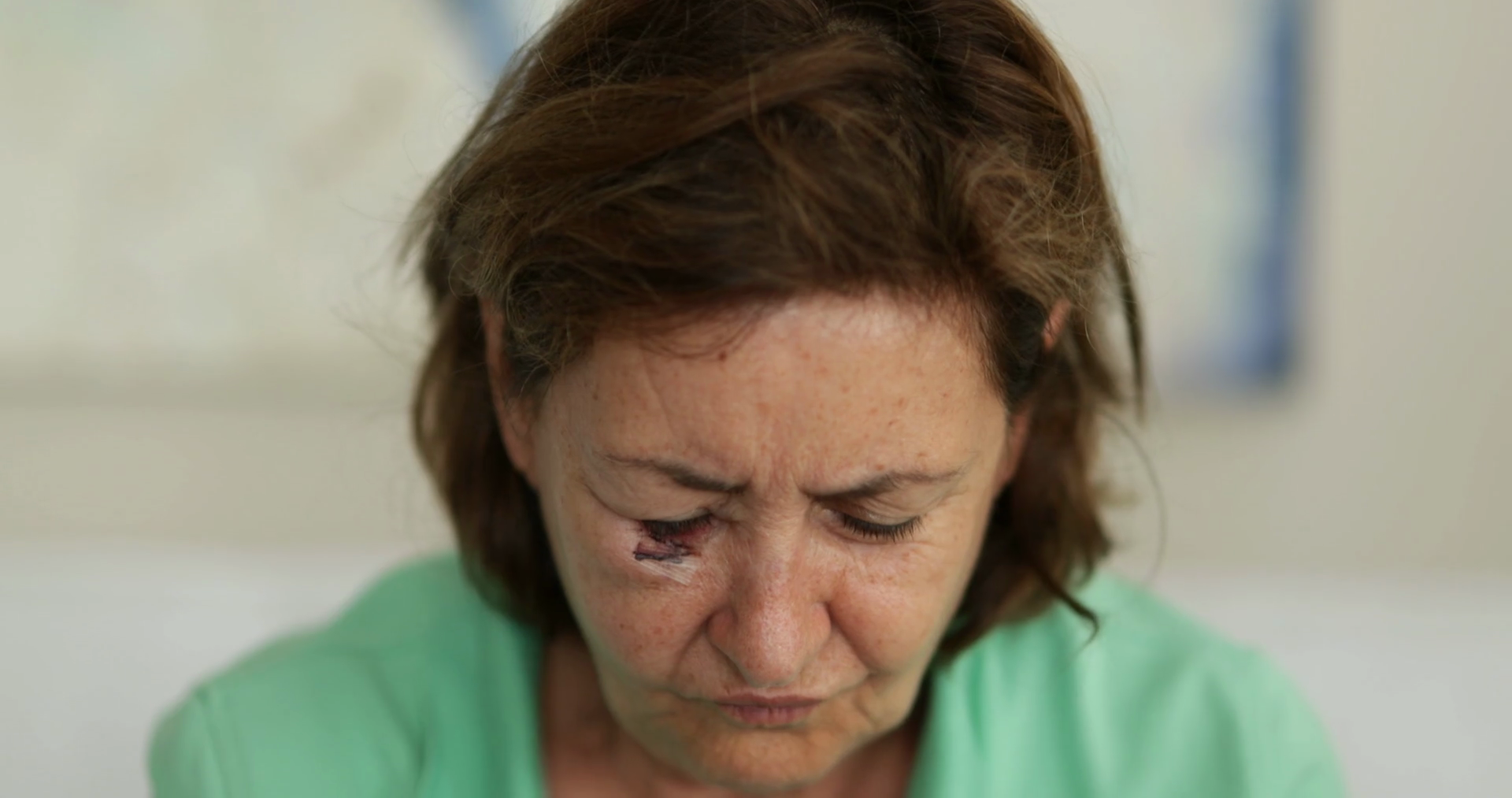 Older Woman With Face Bruise In Face Looking Stock Footage SBV ...