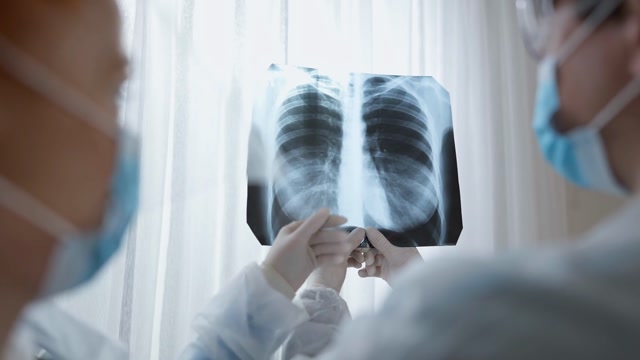 Chest Xray Stock Footage: Royalty-Free Video Clips - Storyblocks