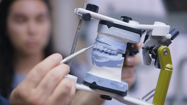 Teeth Cast Stock Footage: Royalty-Free Video Clips - Storyblocks