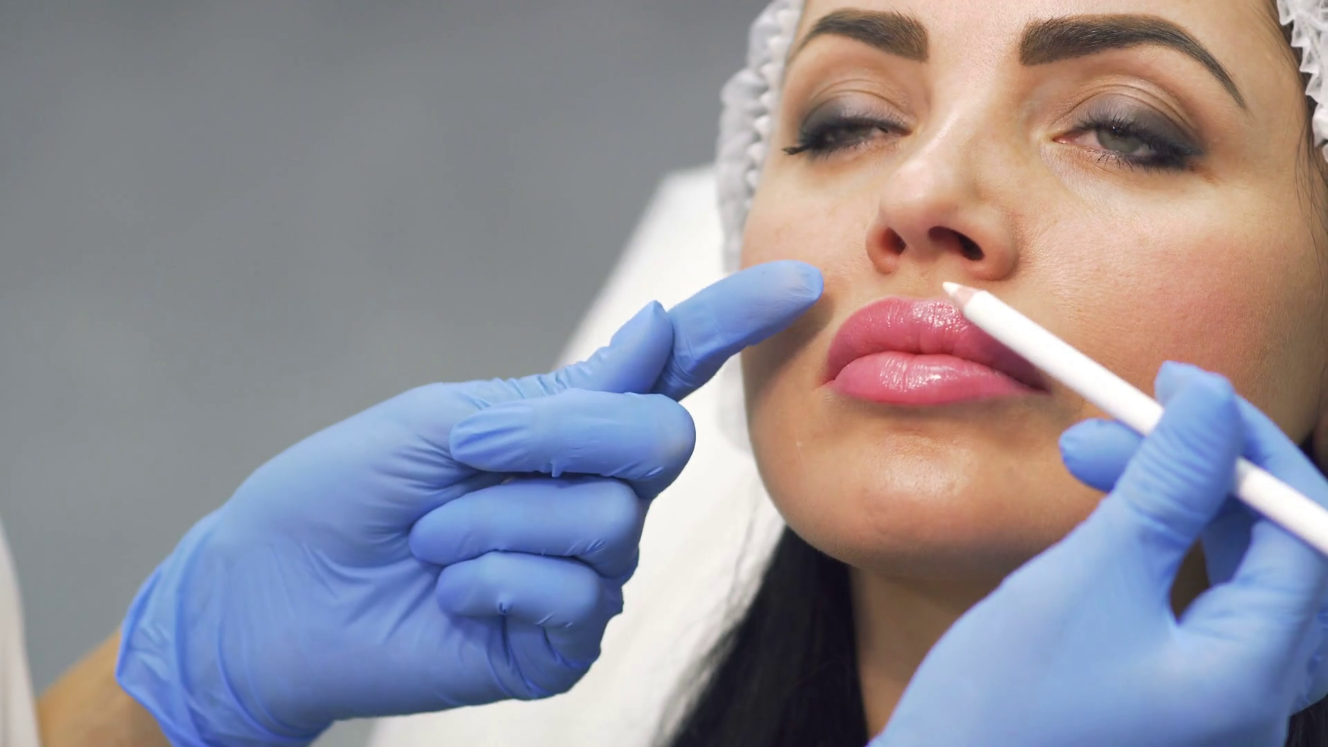 Doctor Marks Facial Zones Botox Procedure Stock Footage SBV-320364373 ...