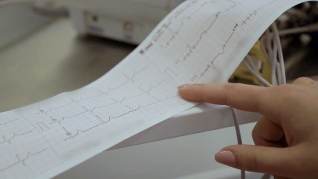 Electrocardiogram Stock Footage: Royalty-Free Video Clips - Storyblocks