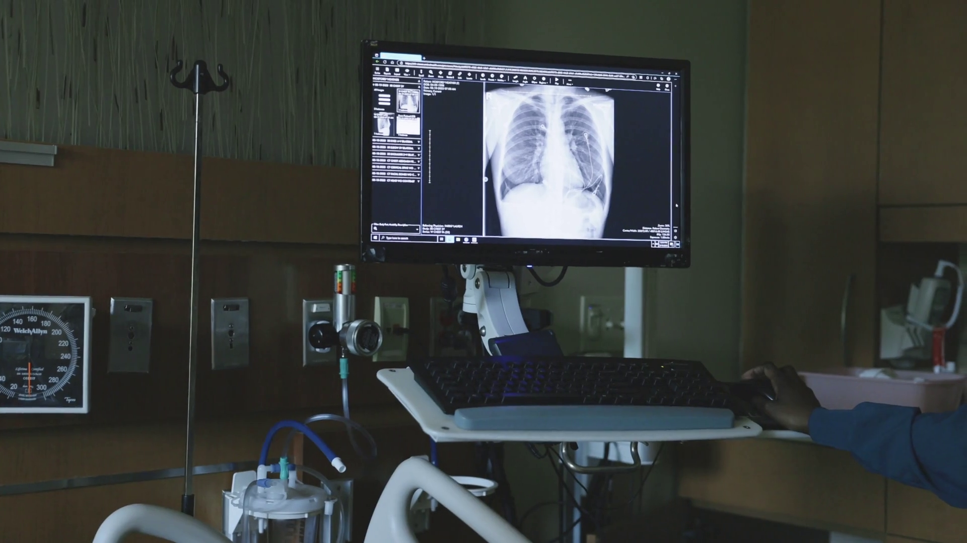 X-ray Scanner System Analysing Organ Stock Footage SBV-347748202 ...