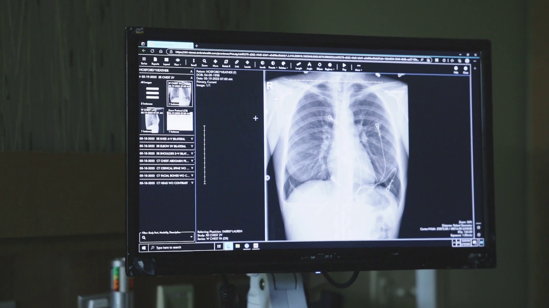 Lung Scan Diagnostic Radiology Doctor Chest Stock Footage SBV-347748206 ...