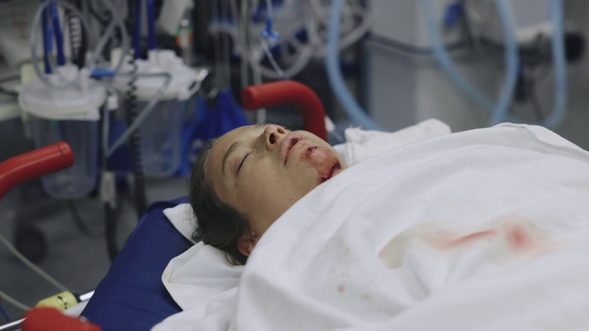 Traumatic Injury Female Close Up In Stock Footage SBV-347662553 ...