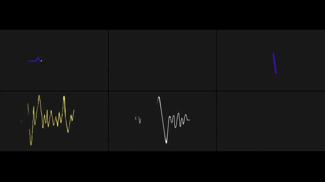 Adrenaline Animation Templates Royalty-Free - Storyblocks