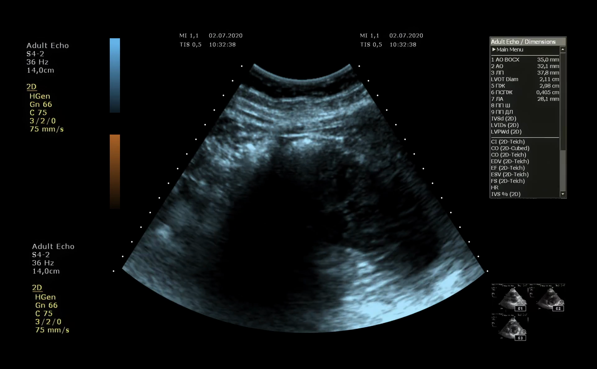 Cgi Video Of Modern Ultrasonography Scan Stock Footage SBV-348500229 ...
