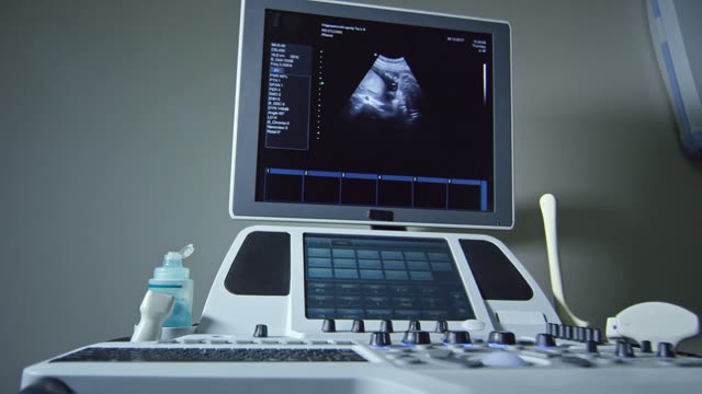 Ultrasound Screen Stock Footage: Royalty-Free Video Clips - Storyblocks