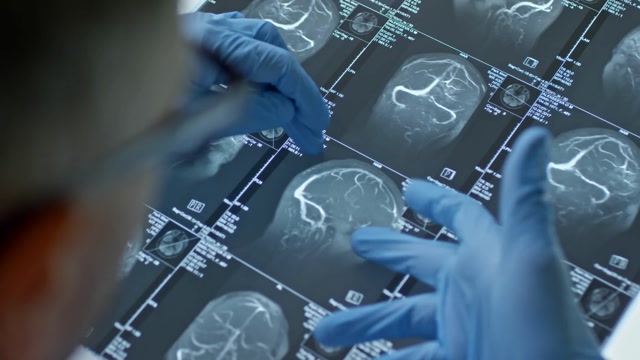 Mri Scan | People stock footage - Storyblocks