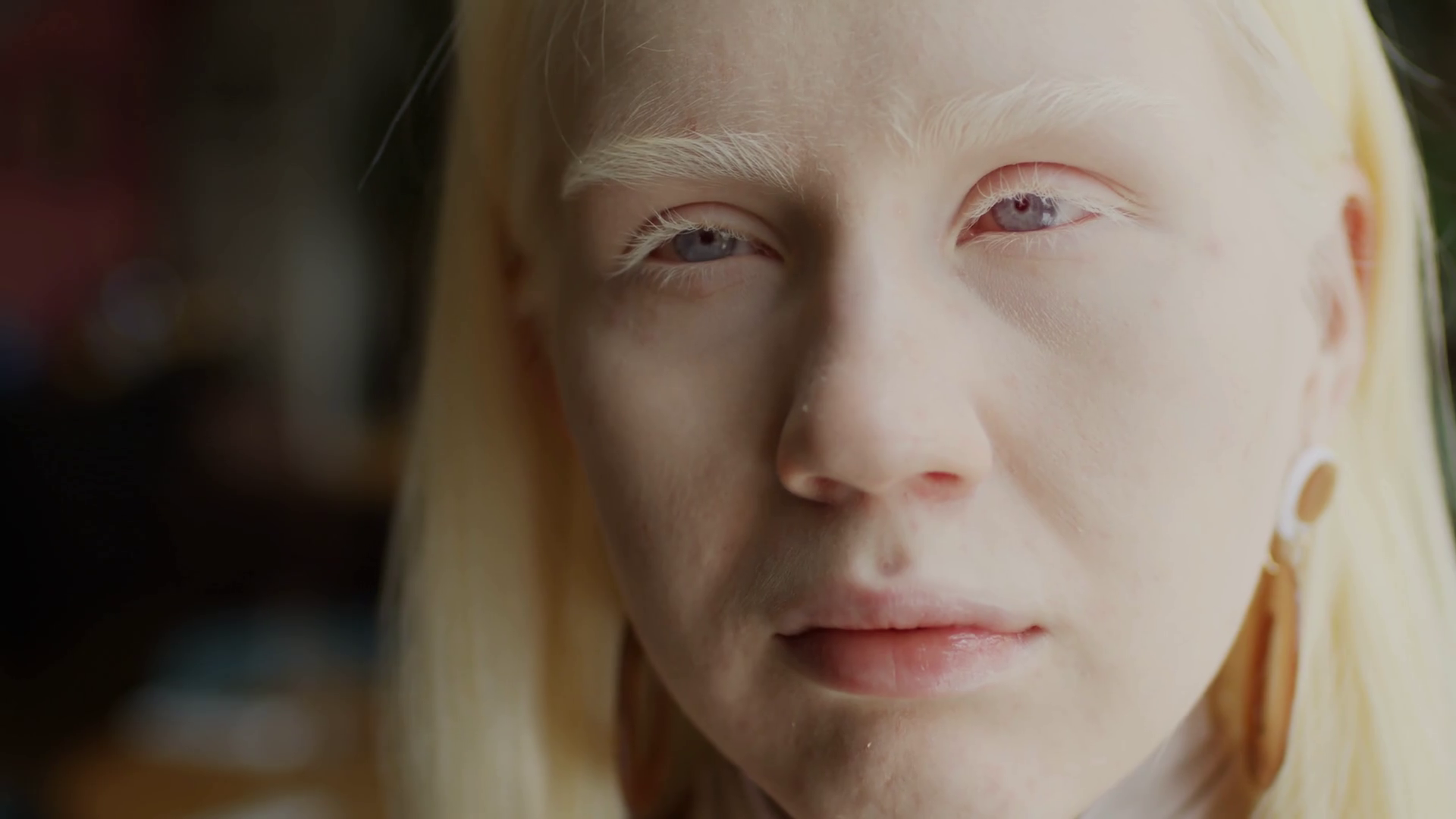 Close-up Portrait Of Young Albino Woman With Stock Footage SBV ...