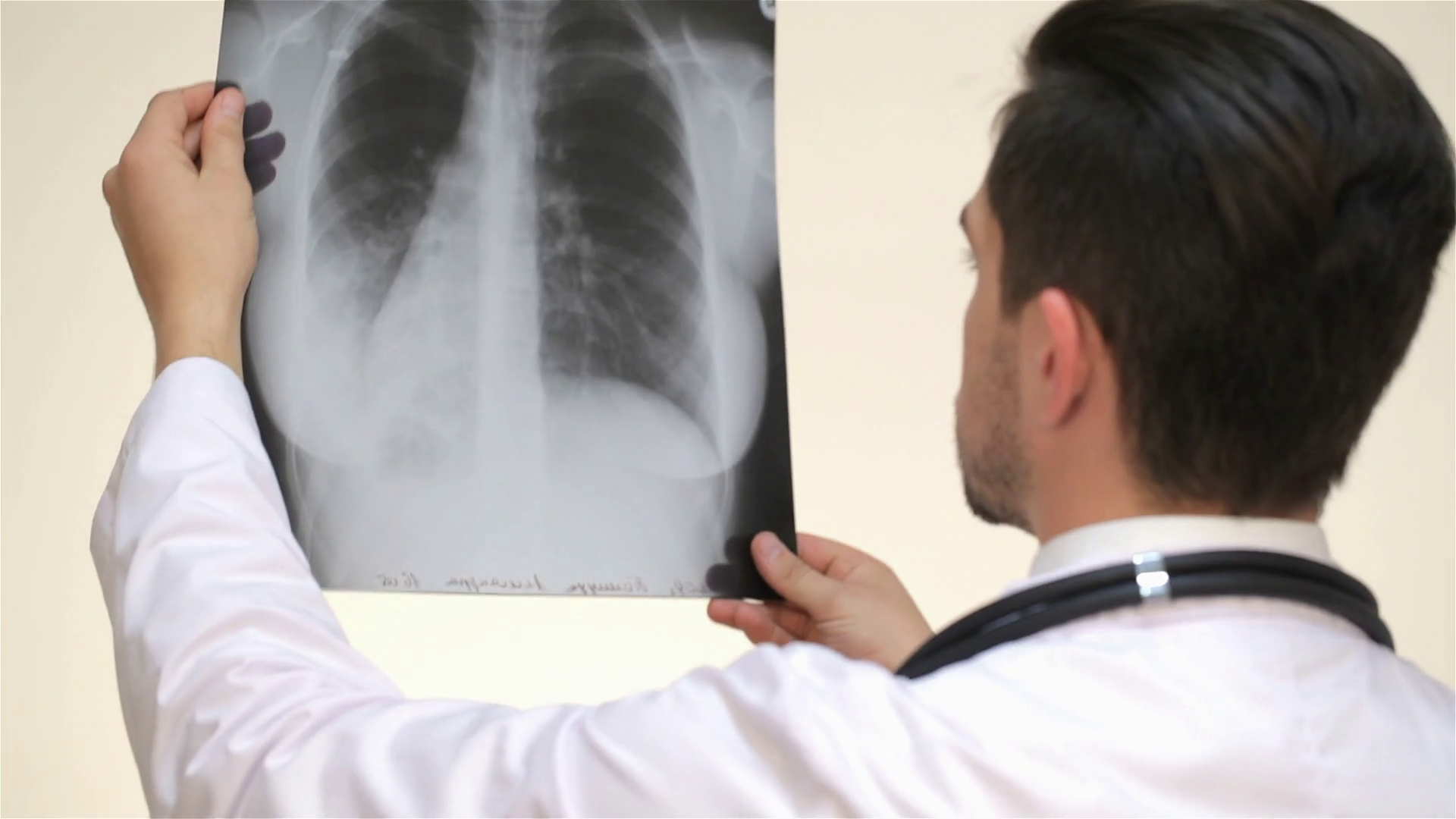 Doctor Examines X-ray View From Back Stock Footage SBV-309734015 ...