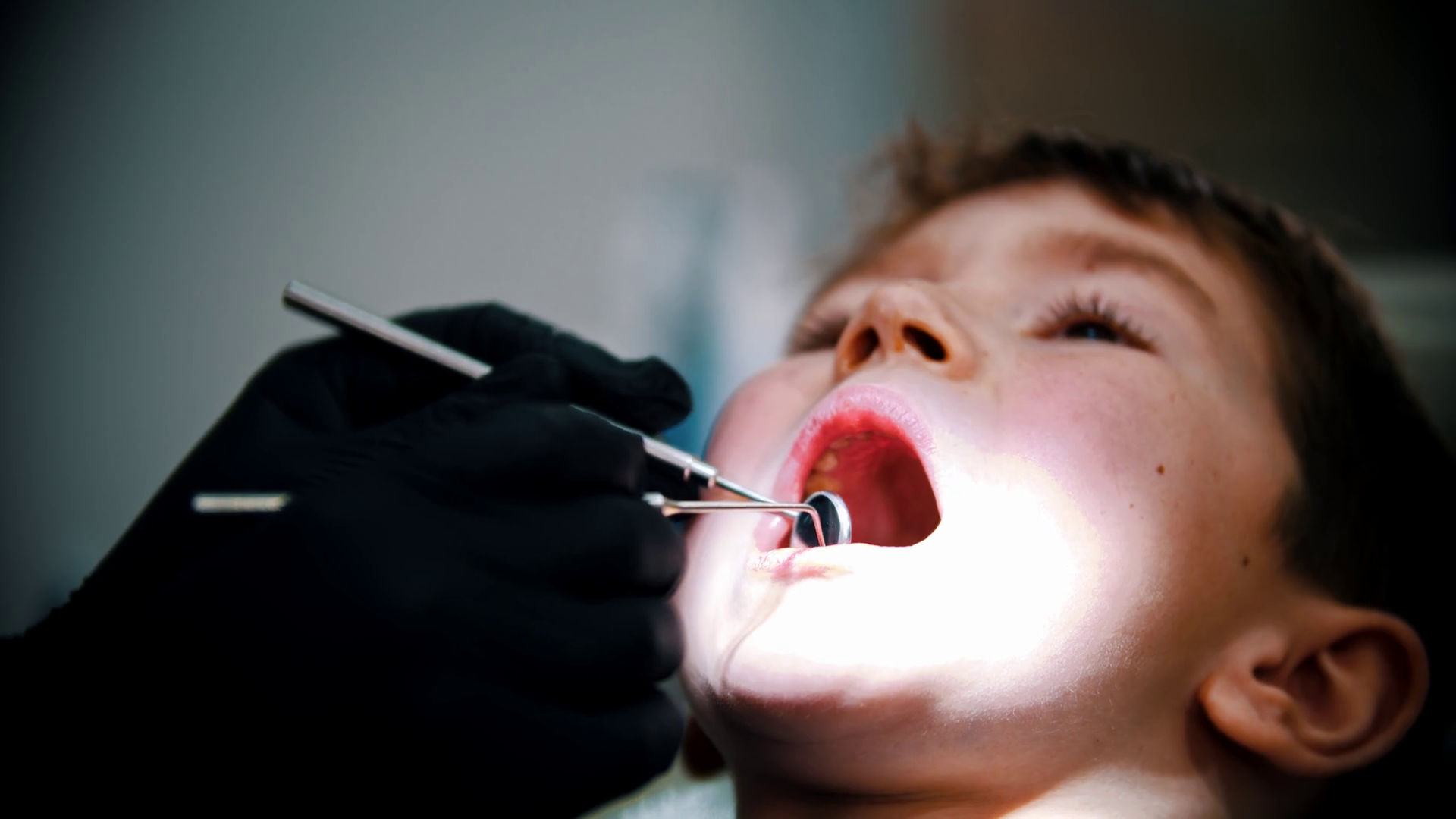 A Little Boy With Damaged Baby Teeth Having Stock Footage SBV-338198075 ...