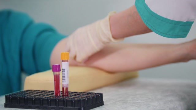 Blood Test Stock Footage: Royalty-Free Video Clips - Storyblocks