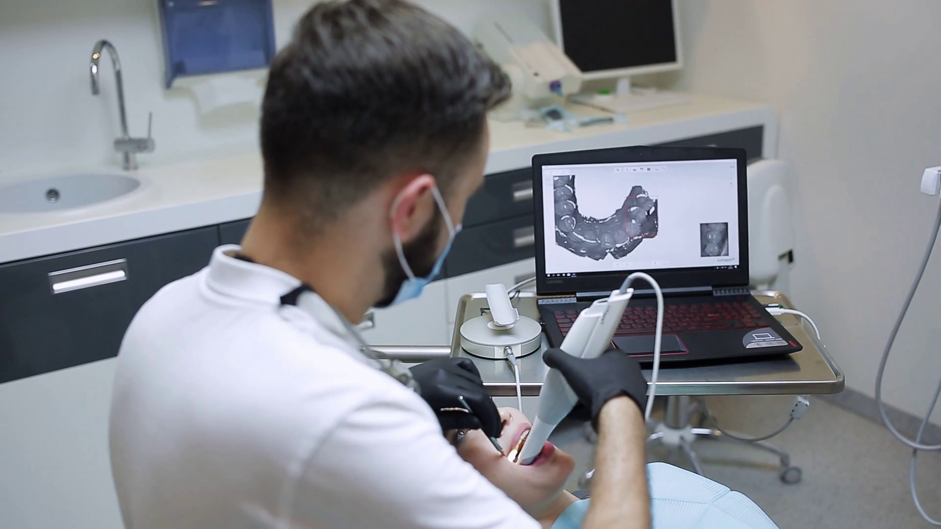 The Dentist Scans Patient's Teeth With 3d Stock Footage SBV-318034730 ...