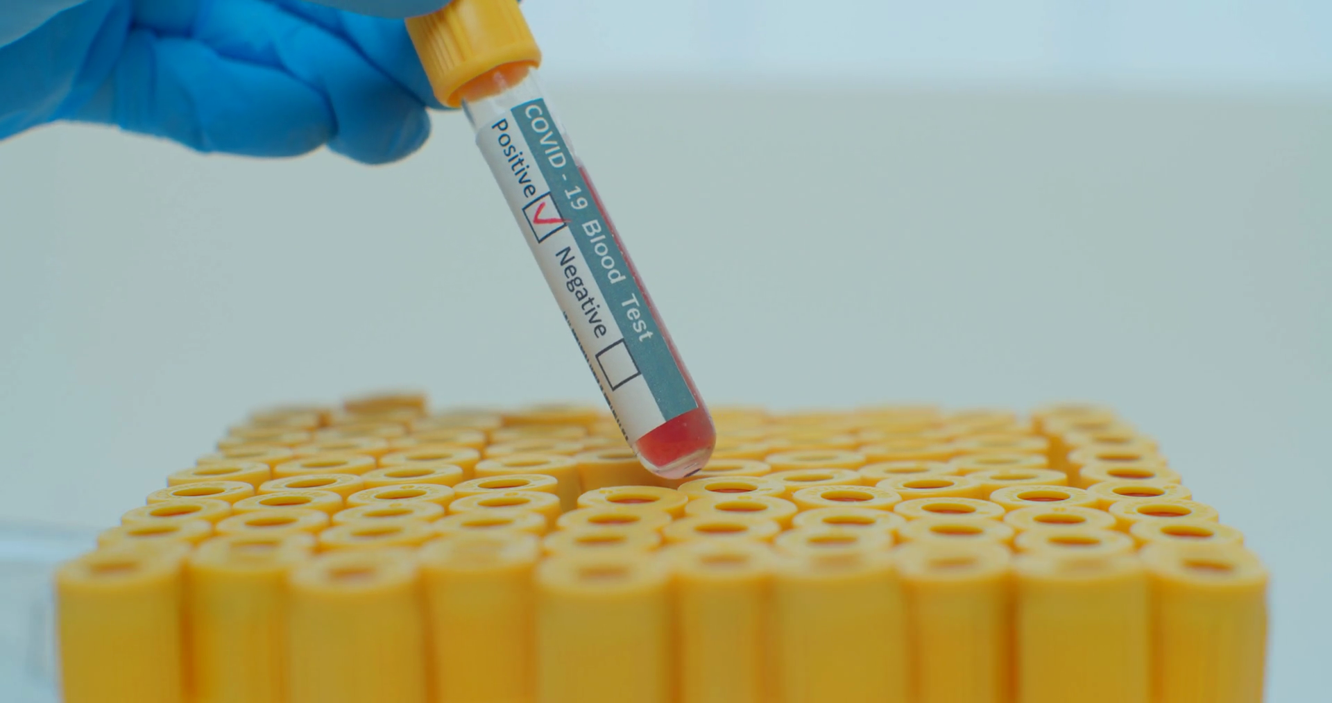 Researcher hand showing tube, positive result of blood test for ...