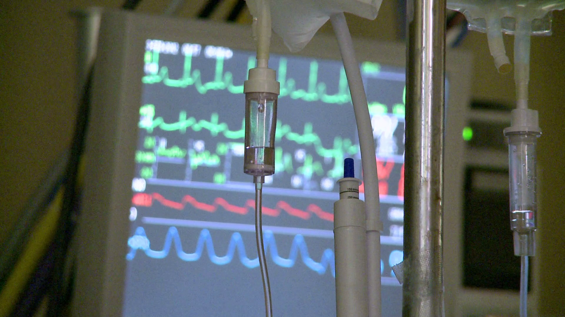 Iv Drips With Vitals Monitor In Background Stock Footage SBV-300844064 ...