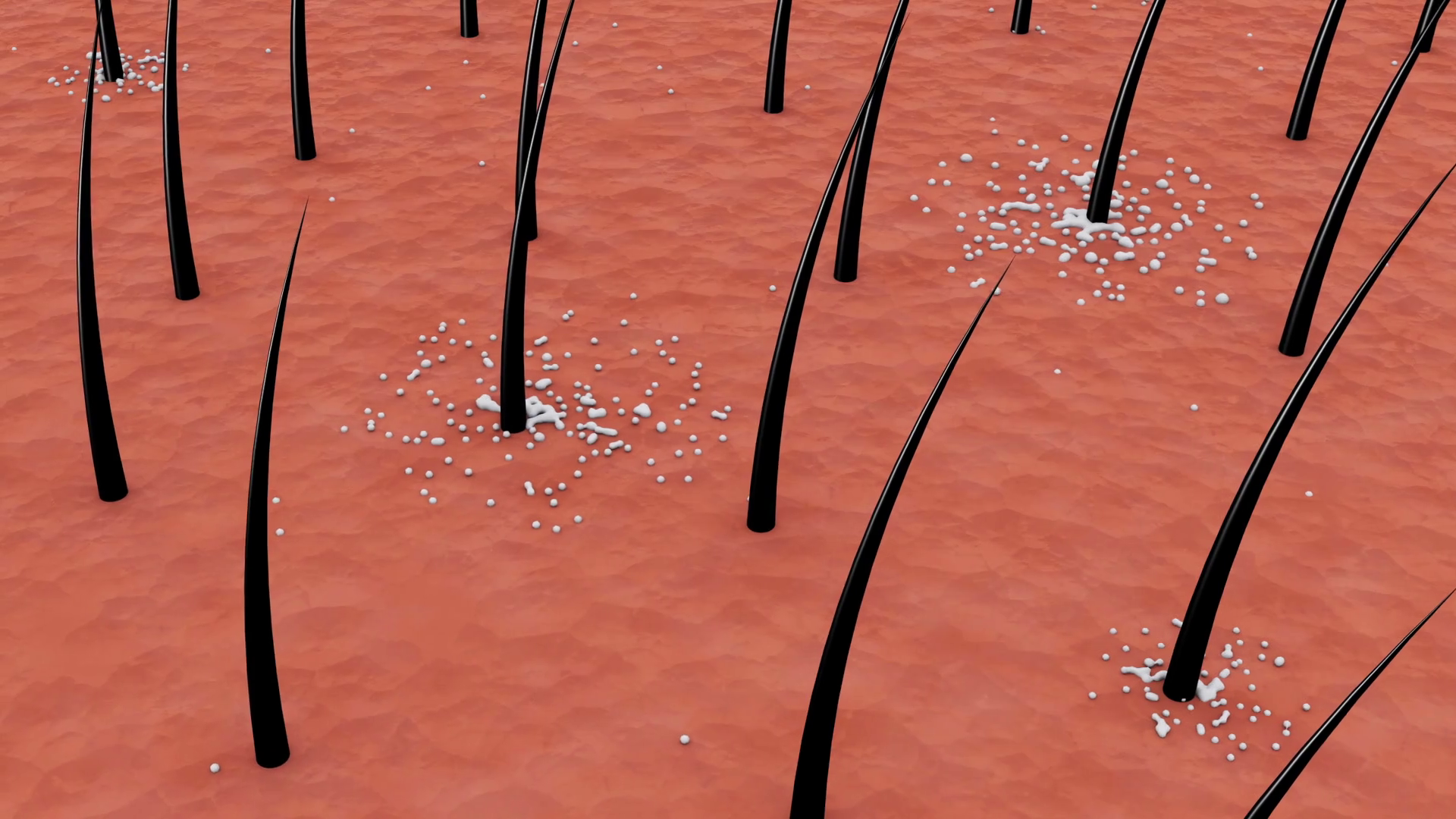 Visualization Of Dandruff In Hair Stock Motion Graphics SBV-311199571 ...