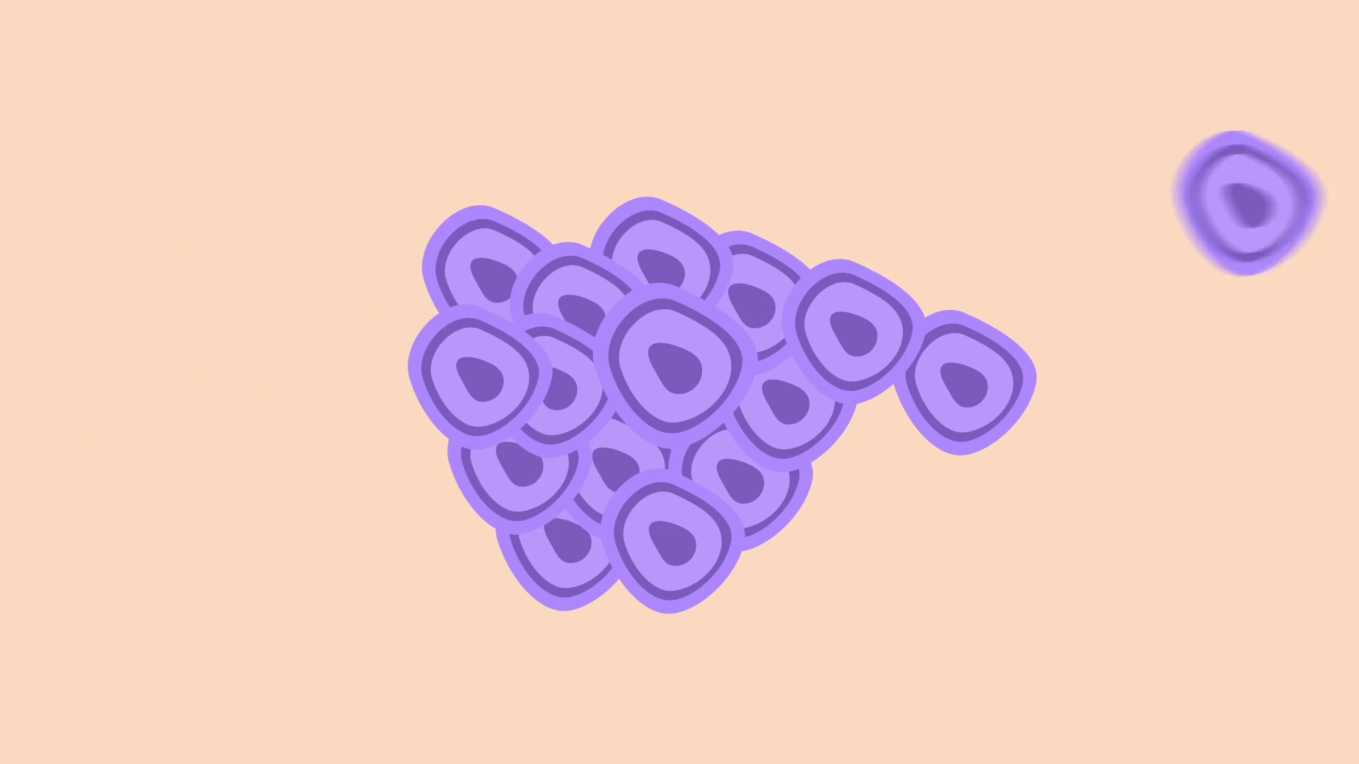 Cancer Cells Forming Tumor In Human Body Stock Motion Graphics SBV ...