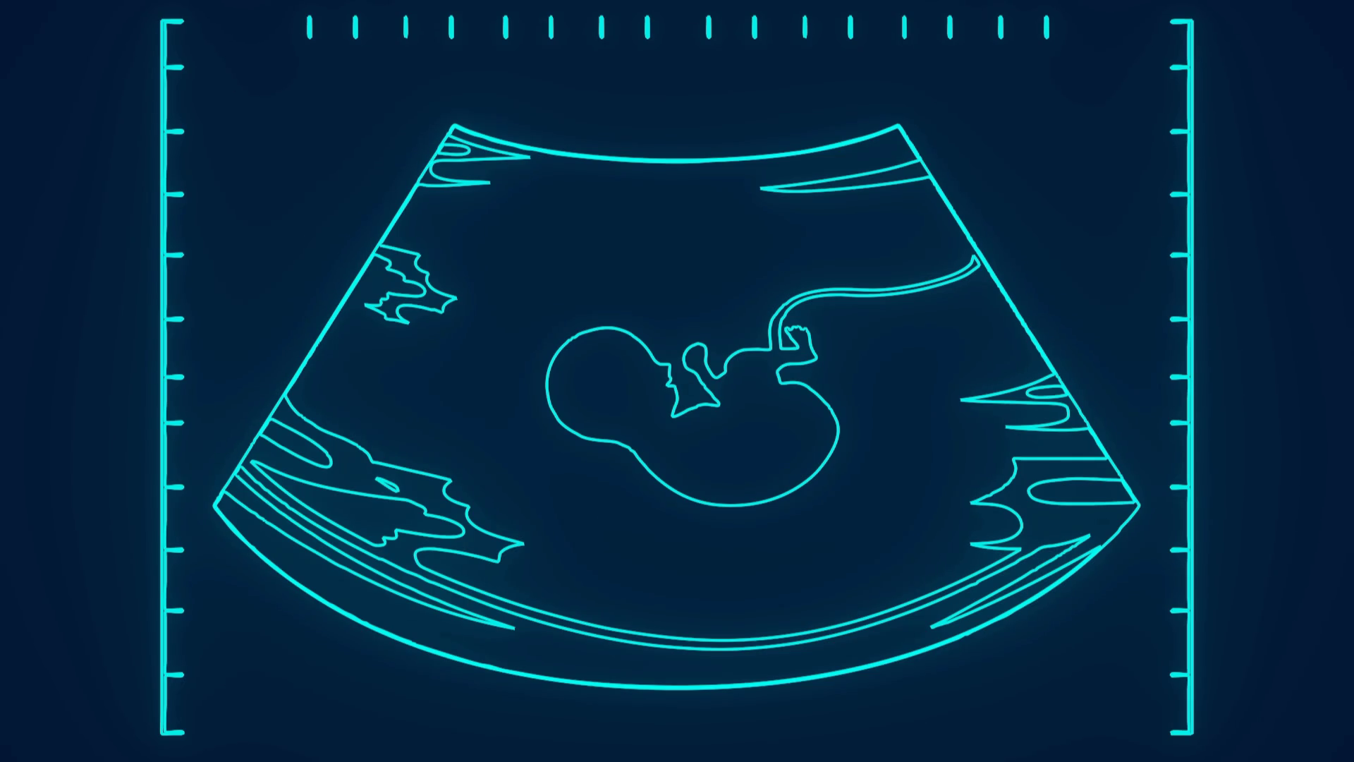 Ultrasound Image Of Baby In Pregnant Women Stock Motion Graphics SBV ...