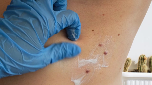 Clean Dead Skin Cell Stock Footage: Royalty-Free Video Clips - Storyblocks